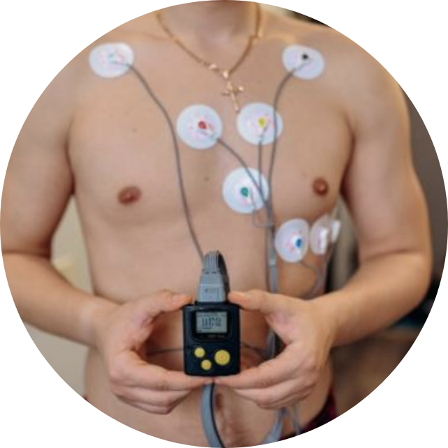Tout savoir sur le holter ECG sur 24 heures